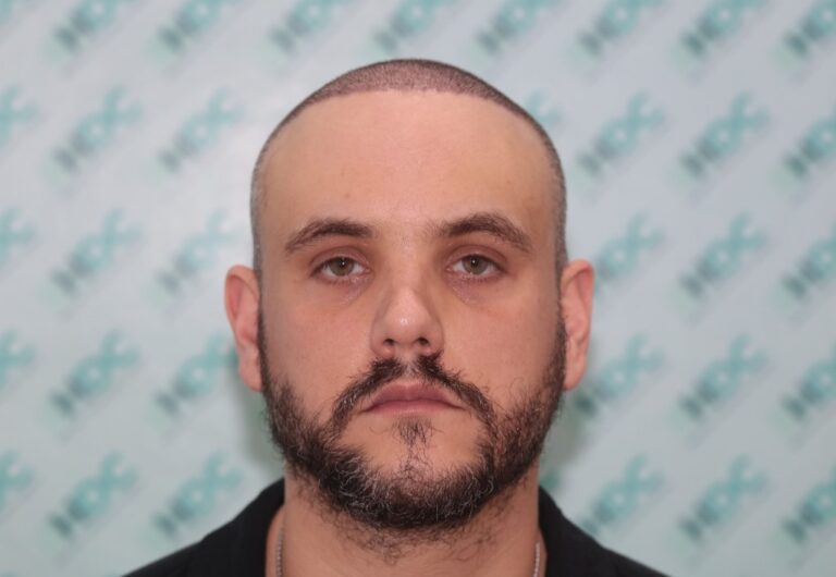 HDC Hair Clinic - Exceptional Hair Transplant Results & Expertise